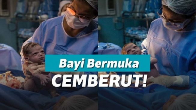 Nggak Suka Dilahirkan? Bayi Ini Langsung Pasang Wajah Cemberut