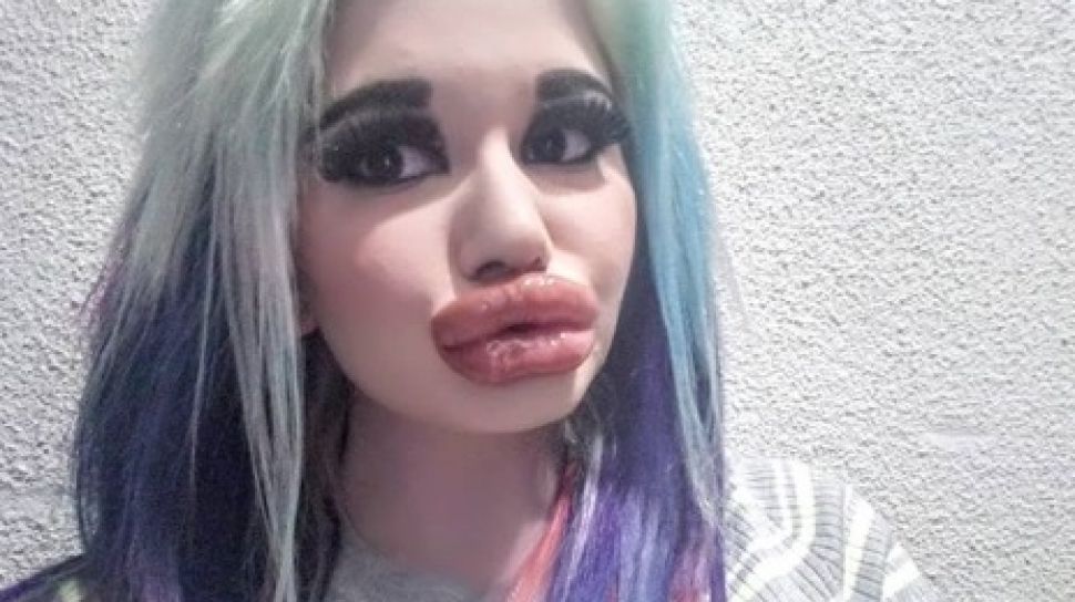 Kenalkan Andrea Ivanova, Pemilik Bibir Paling Dower di Dunia