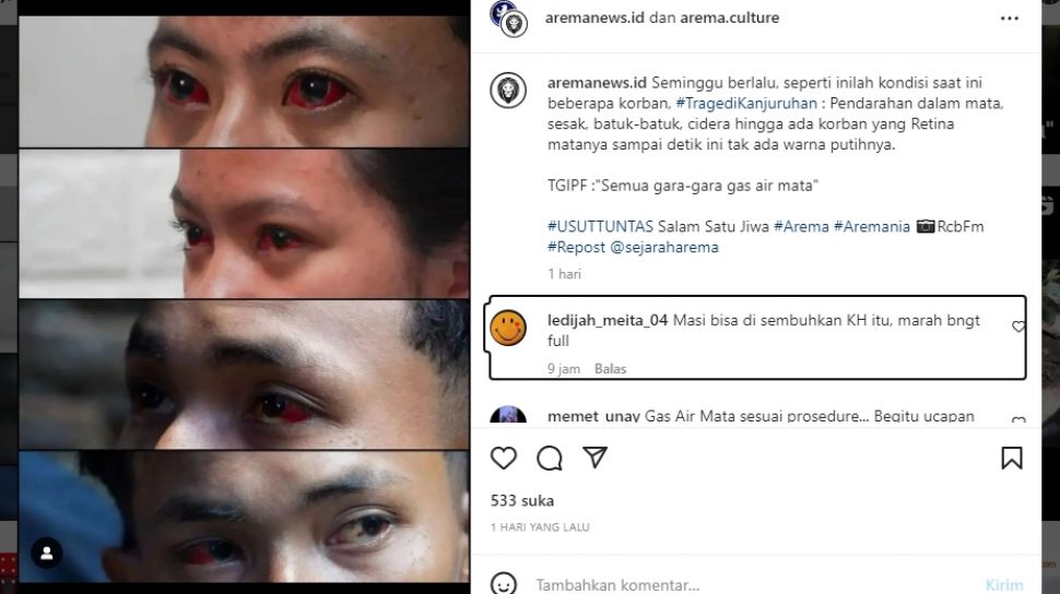 Kondisi Korban Selamat Tragedi Kanjuruhan Viral di IG, Mata Merah dan Sesak Nafas, Warganet ...