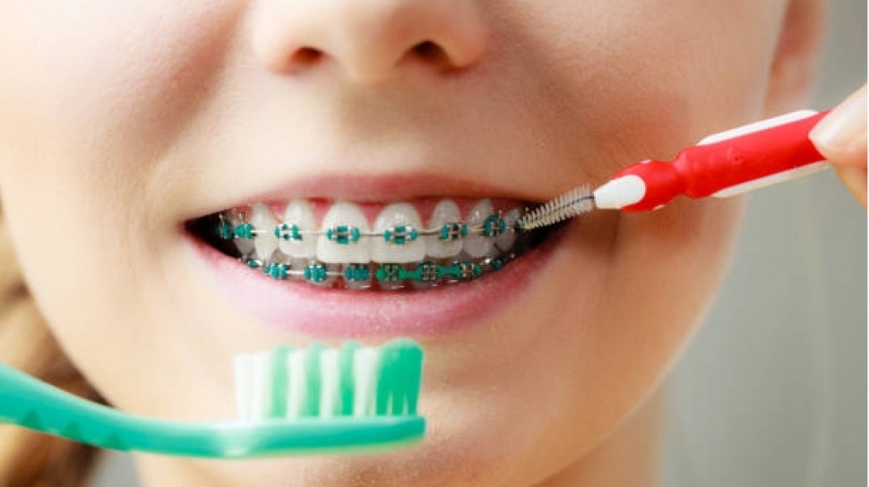 Harus Kontrol Behel saat Puasa, Apakah Bikin Batal?