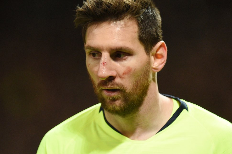 Wajah Messi Berdarah-darah Dihajar Chris Smalling