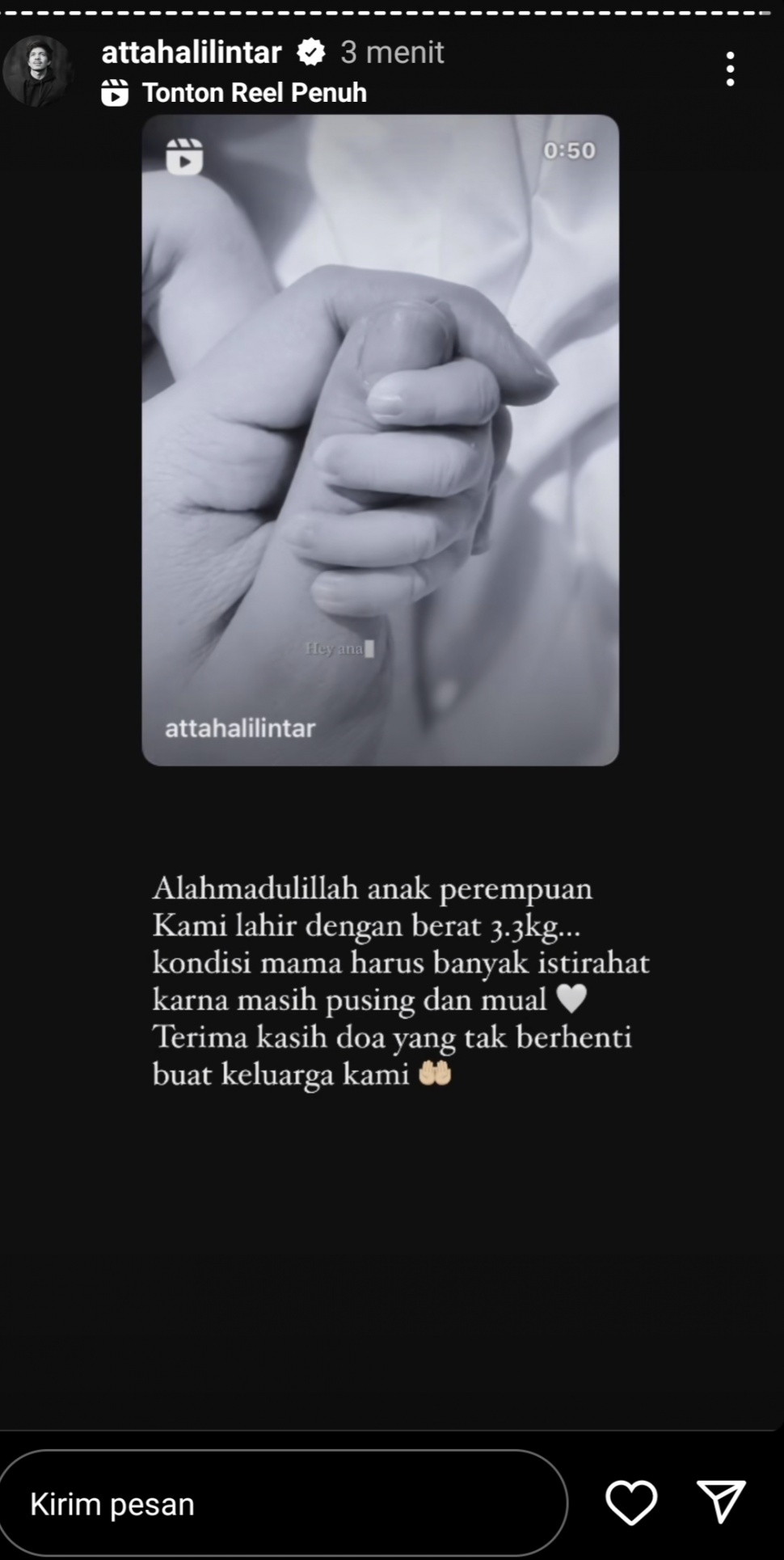 Selamat! Aurel Hermansyah Melahirkan Anak Kedua di Tanggal Cantik